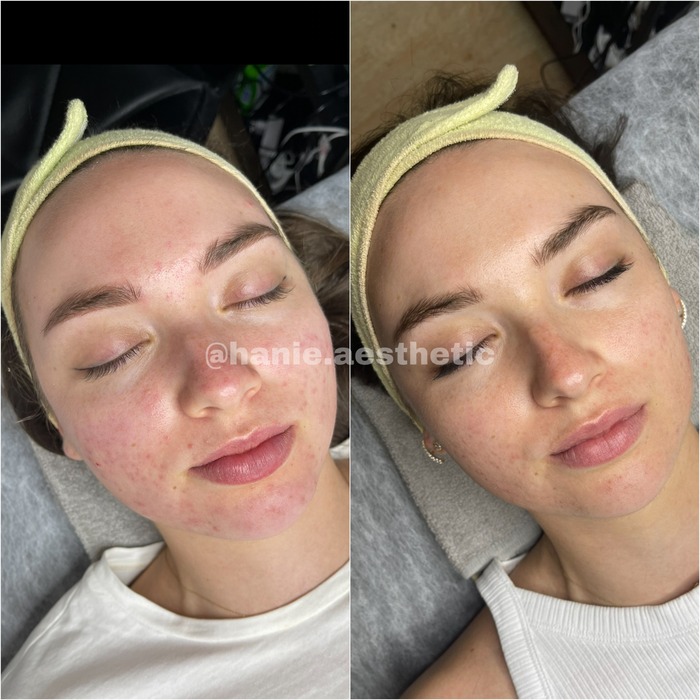 Proměny :: Hanie Aesthetic